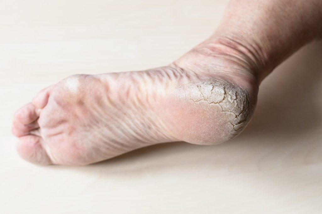 Podiatry – On the Move Podiatry